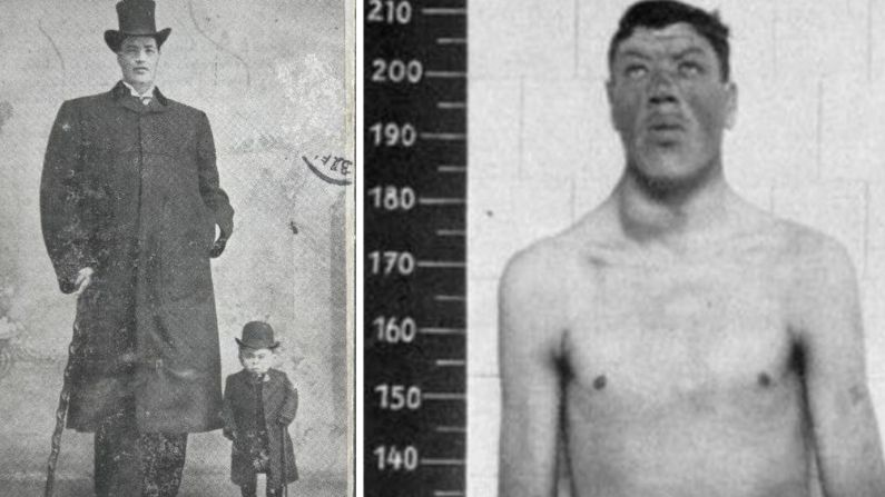 The 9 Weirdest People In History - Museum Facts